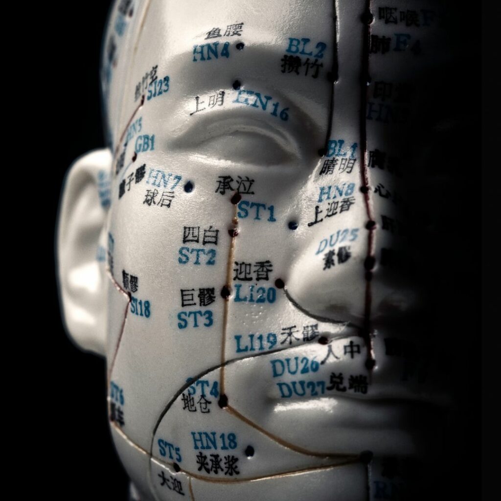 Formation acupuncture en présentiel | Acupuncture Nguyen